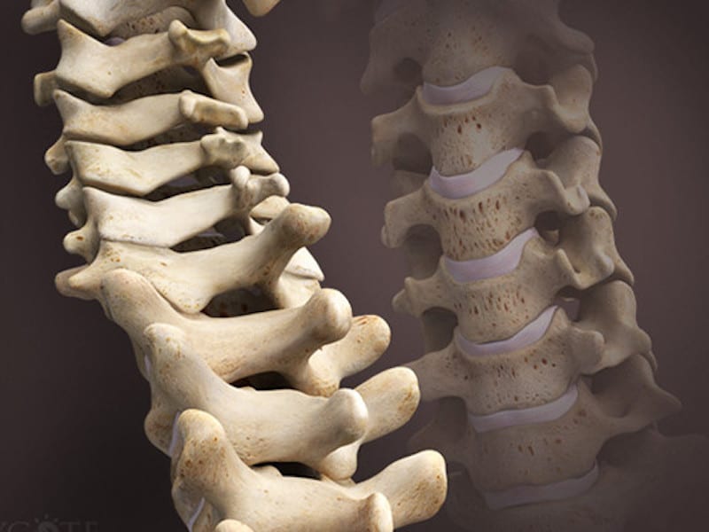Disco Intervertebrale: Anatomia e Biomeccanica | La Scienza in palestra